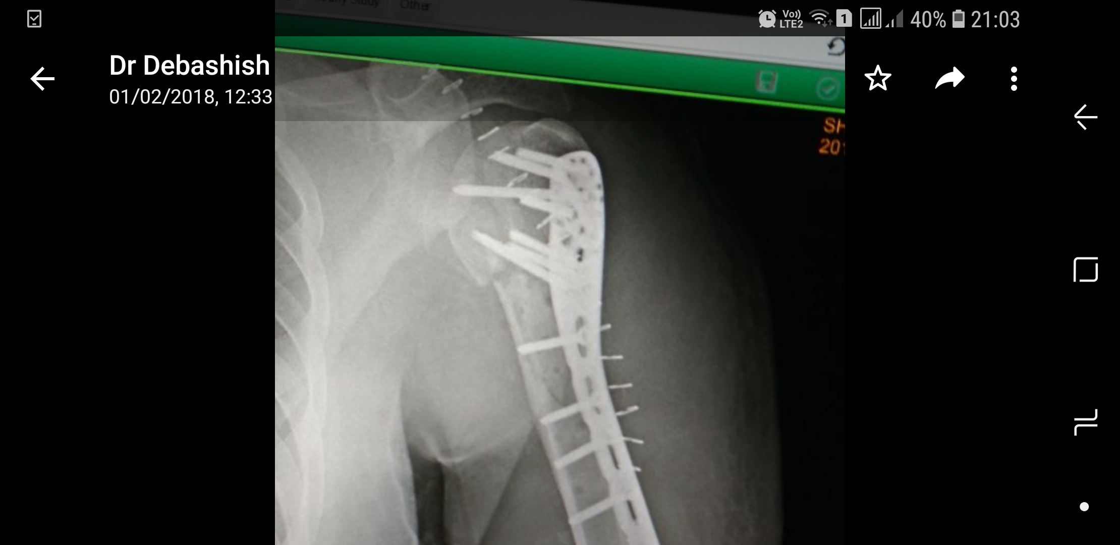 Gallery | Joint and Bone Solutions